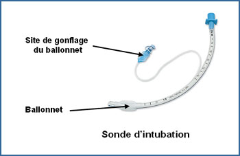 Sonde_intubation - Médecine Intensive Réanimation